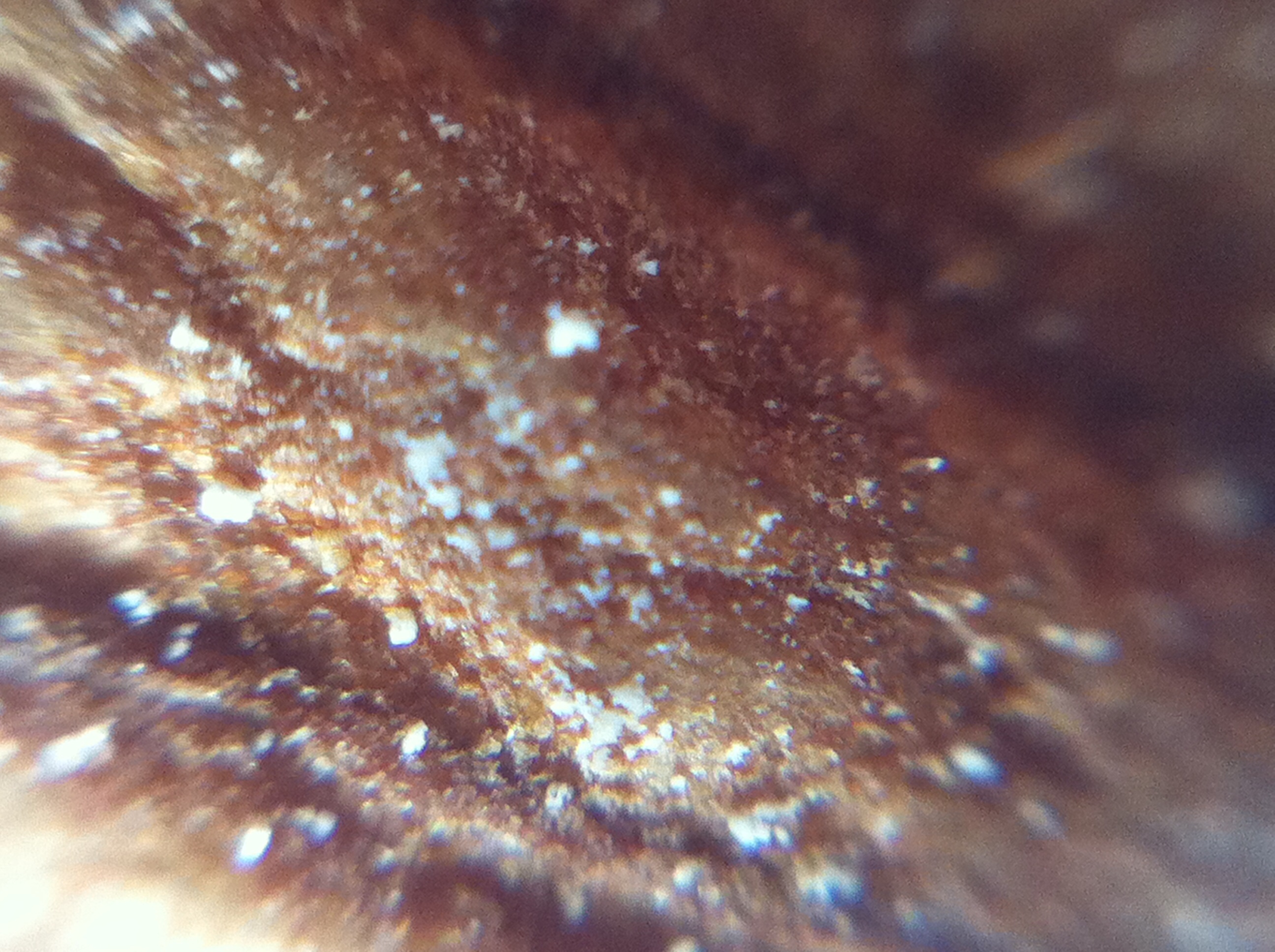 iPhone Microscope – Erica Warkus, M.D., Ph.D.